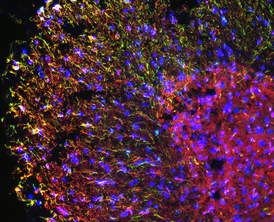 Scott Memorial Library